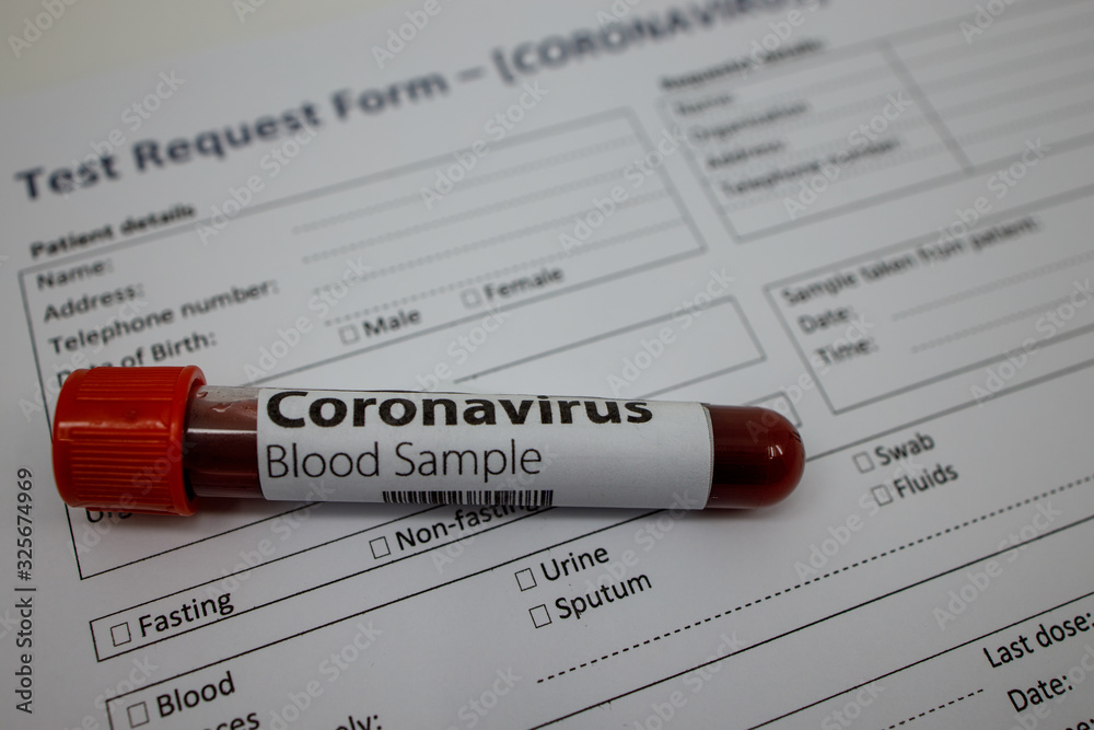 Blood sample for the new rapidly spreading Coronavirus that originated ...