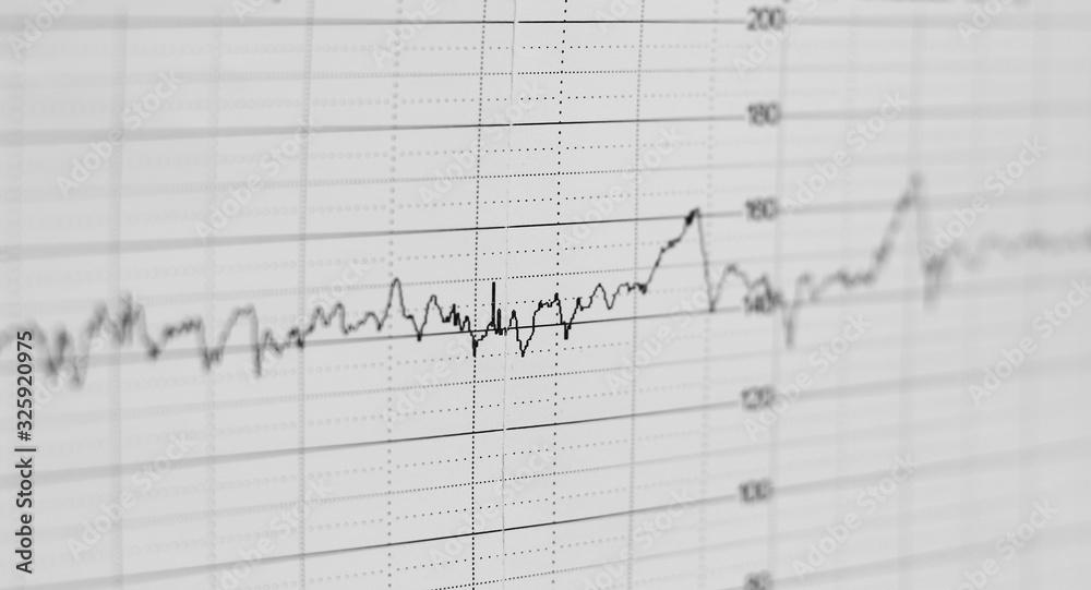 ecg graph, electrocardiogram ekg on paper Stock Photo | Adobe Stock