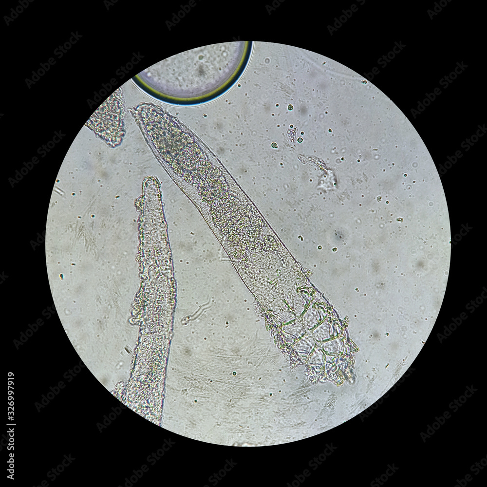 Demodex mite from a microscope view. The parasite causing a skin ...