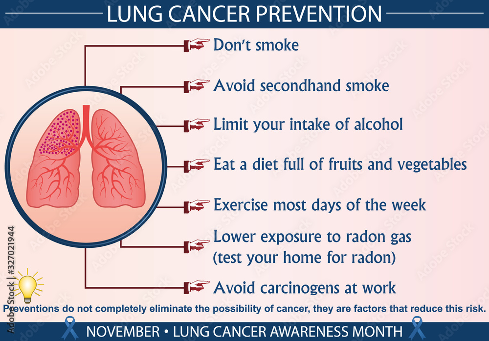 Lung cancer prevention infographic vector illustration. Health ...
