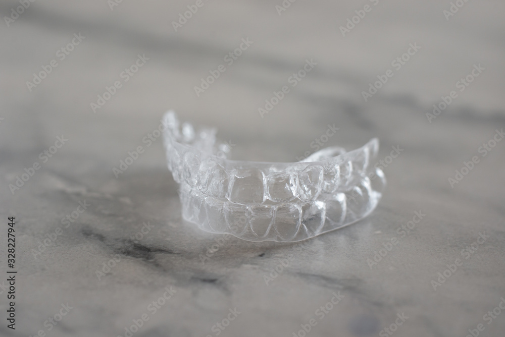 Invisalign orthodontics aligners, Invisible braces aligner. Mobile ...