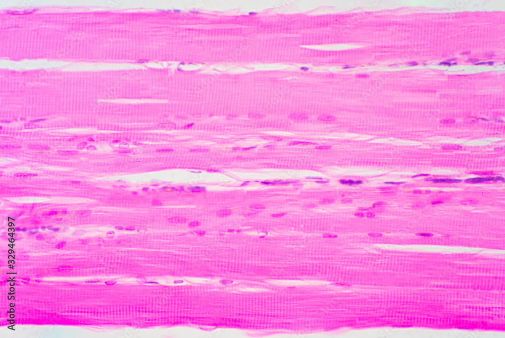 Human skeletal muscle under microscope view for education pathology ...