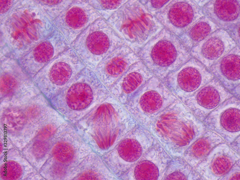 Photo Stock Cells of an onion root tip undergo mitosis. Anaphases and ...