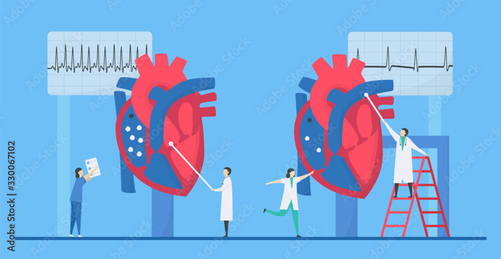 Cardiology vector illustration. This heart disease problem is ...