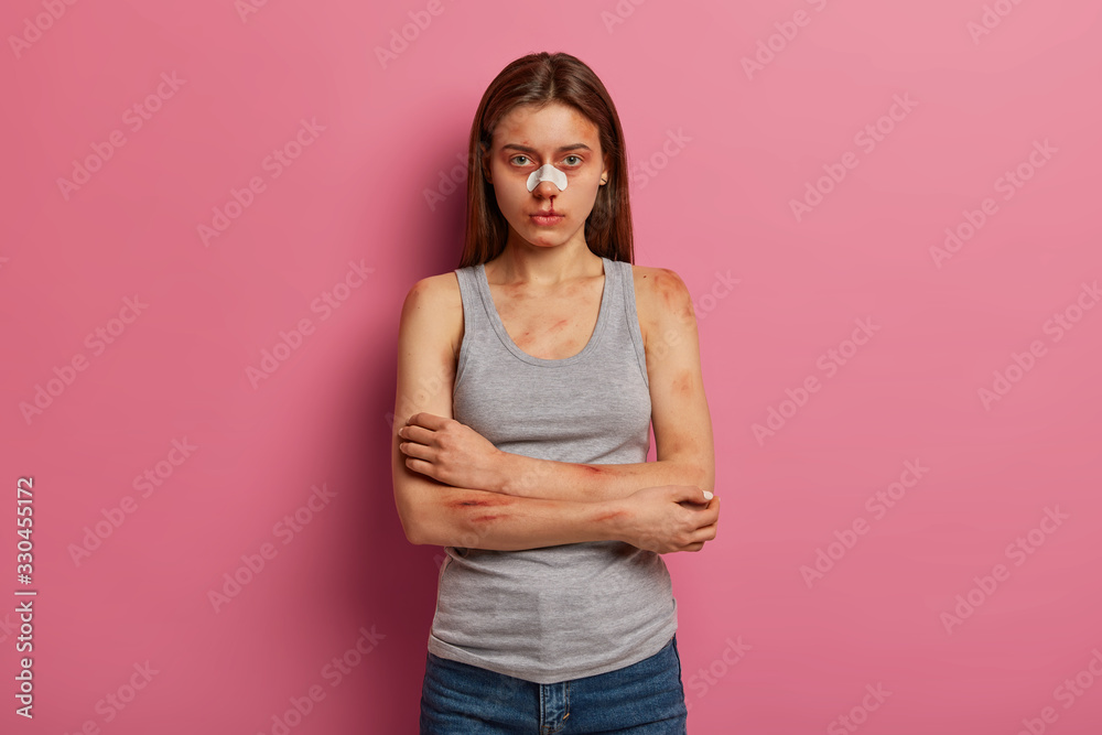 Serious young woman got nose bleed after insident, keeps arms folded ...
