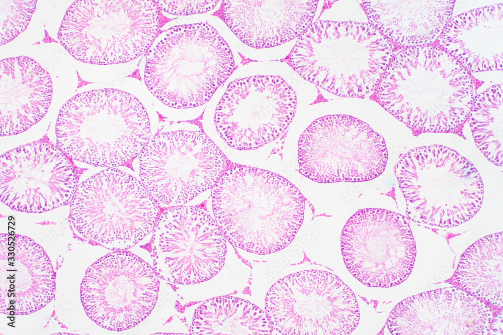 Human testis under microscope view. Shows spermatogonia, spermatocytes ...