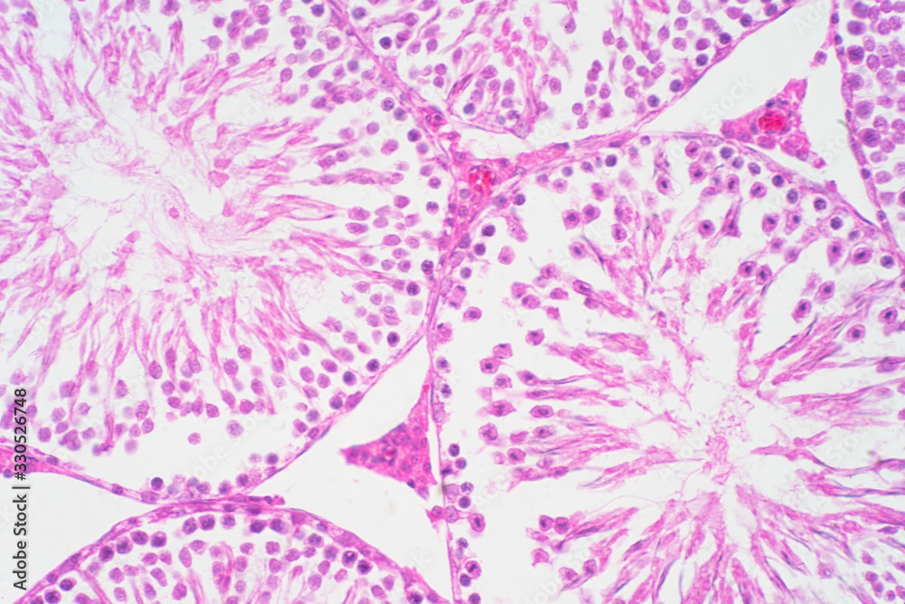 Human testis under microscope view. Shows spermatogonia, spermatocytes ...