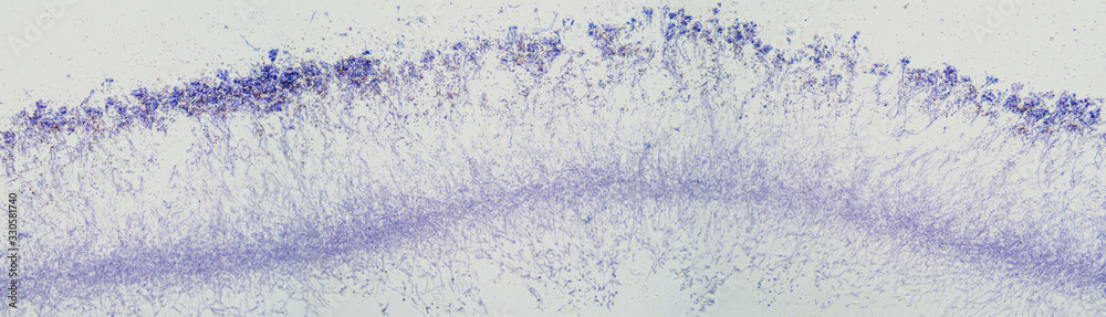 Penicillium, ascomycetous fungi, under the microscope. To humans ...