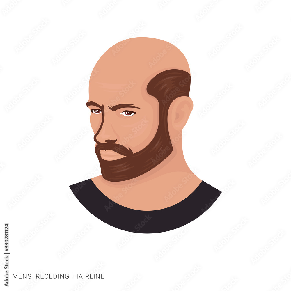 Vector illustration of a man with receding hairline and hollywoodian ...