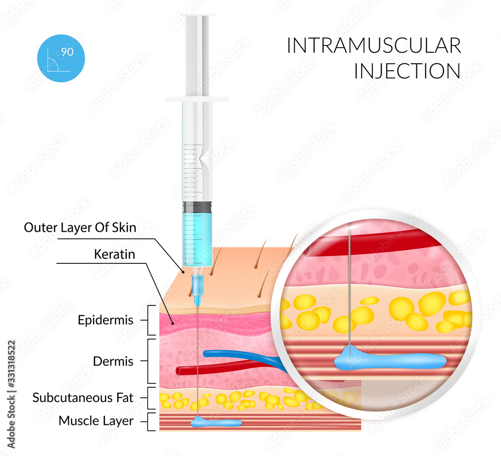 Realistic image of Intramuscular injection on a white background with ...