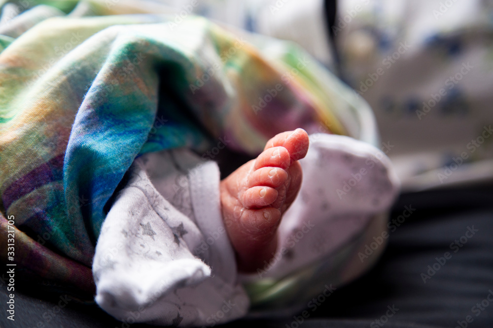 Newborn baby foot with dry, wrinkled, cracked, peeling skin. Overdue so ...