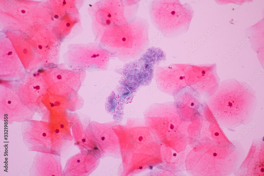 Foto de Stock View in microscopic of Candidiasis, fungus infection ...