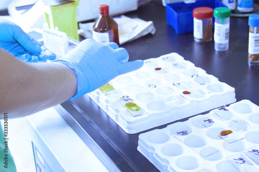 Fotografie Histology test lab in hospital. Hands in gloves, tech loads ...