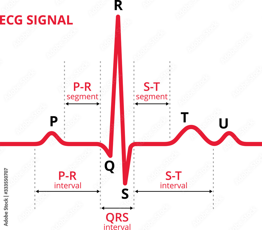 Electrocardiogram ECG or EKG heart beat graph signal pulse color and black on white background ...