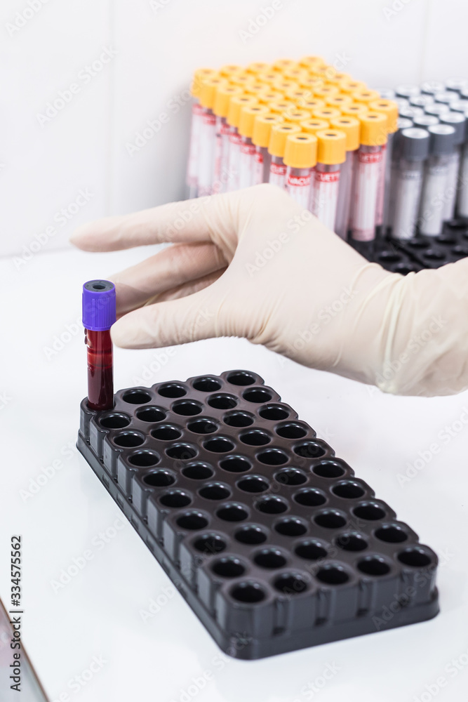 Covid-19, coronavirus, pandemic and viruses concept - hand holding ...