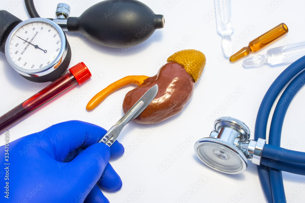 Concept photo of kidney surgery, operation of kidney resection or ...
