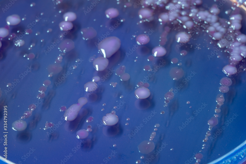 bacterial colonies on agar medium petri dish plate plate on MacConkey ...