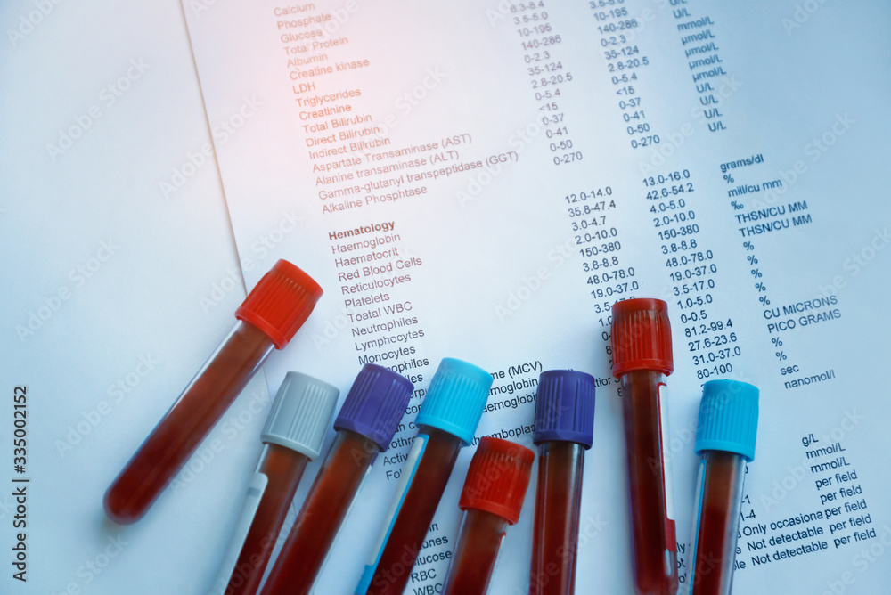 Fotografie Disposable EDTA tubes filled with blood over the list of ...
