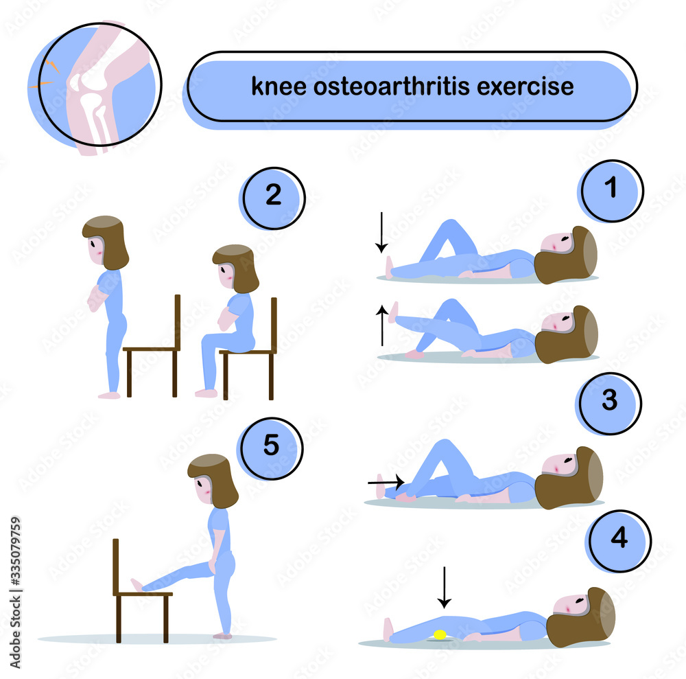 Knee Osteoarthritis Exercise For Knee Pain Stock Vector Adobe Stock