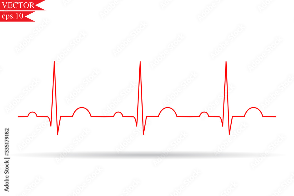 Image vectorielle Stock Electrocardiogram show normal heart beat line (Sinus rhythm). ECG. EKG ...