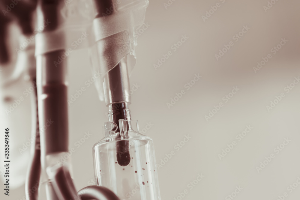 Stockfoto Coma patient on hopital bed take care by doctor nurse due to ...