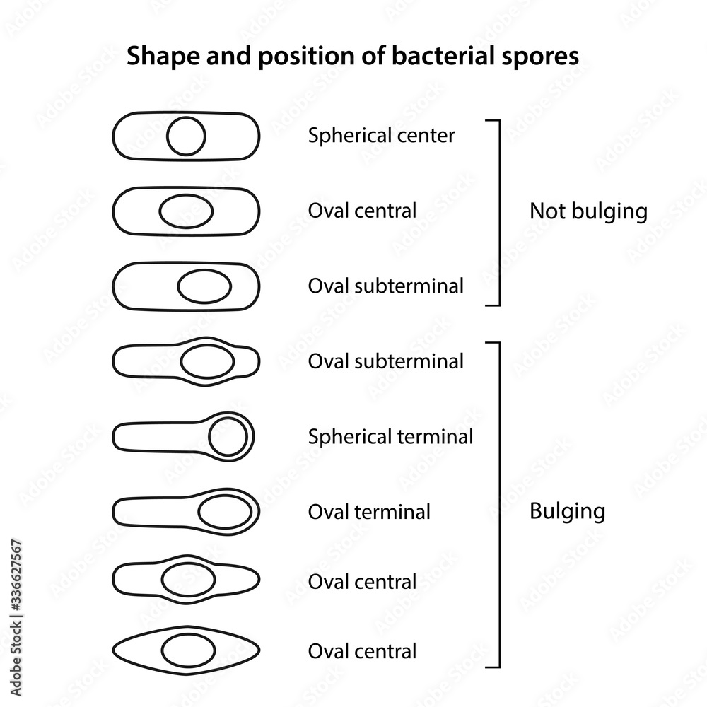 Shape and position of bacterial spores in bacterii. The shapes of ...