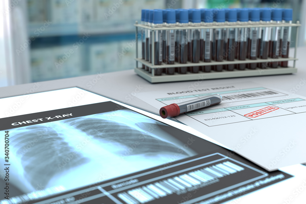 Illustration Stock Scene in the lab with a lung x-ray and a test tube ...
