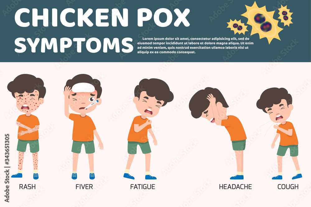 Children has chicken pox infographic, Poster children fever and ...