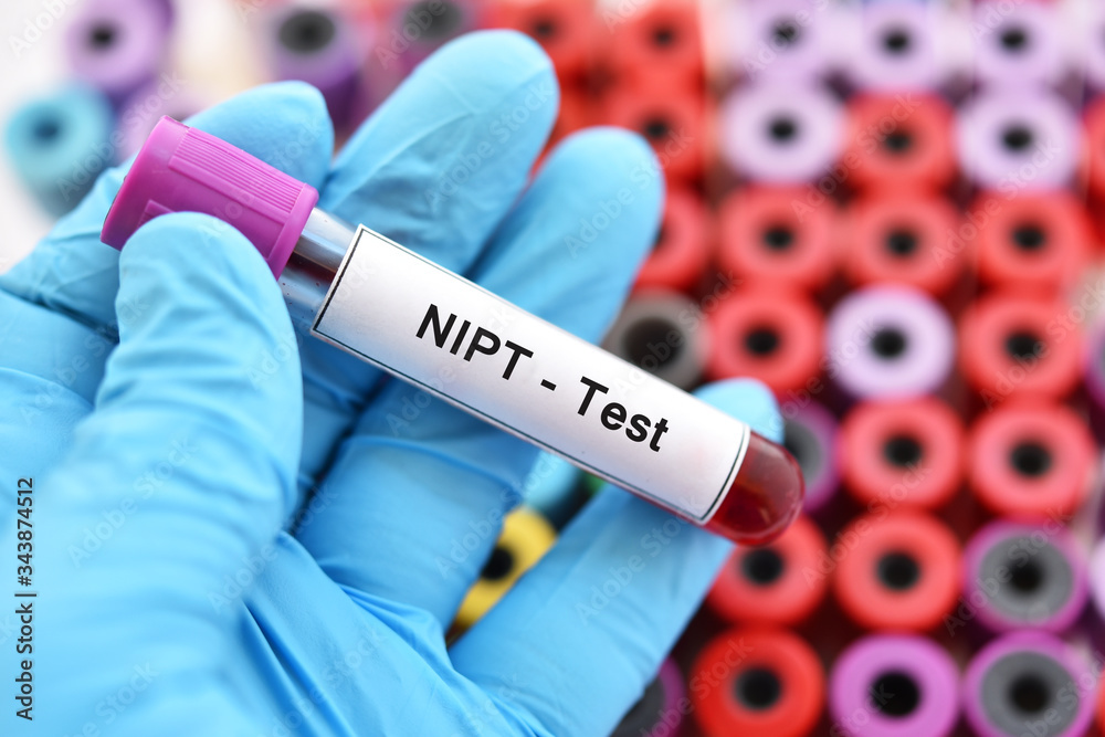 Blood sample tube for NIPT test or non-invasive prenatal testing ...