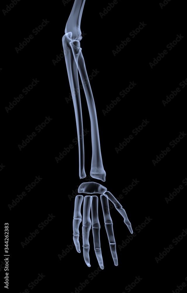 anatomy, human, roentgen, skeletal, anatomical, bone, image, medical ...