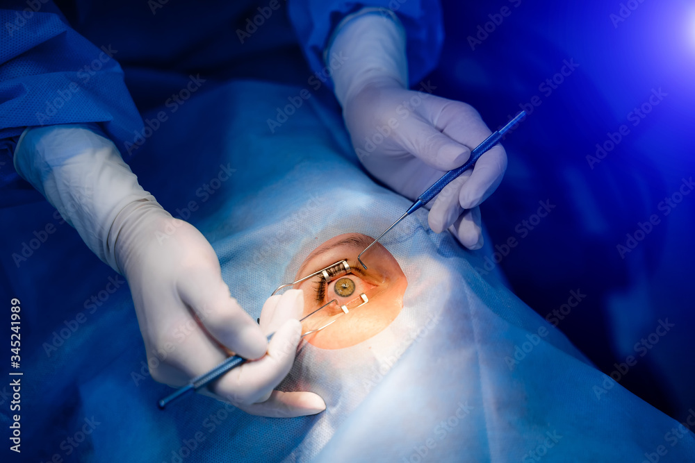 Laser vision correction. A patient and a surgeon in the operating room ...