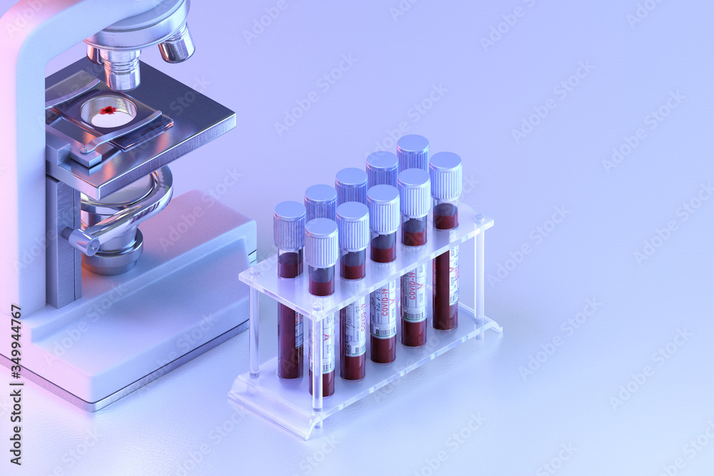 Coronavirus testing: viral disease coronavirus covid-19 SARS-CoV-2 ...