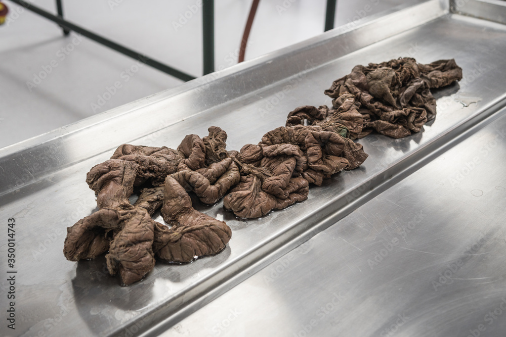 Real human large intestine (colon) on a table. Kept in refrigeration ...