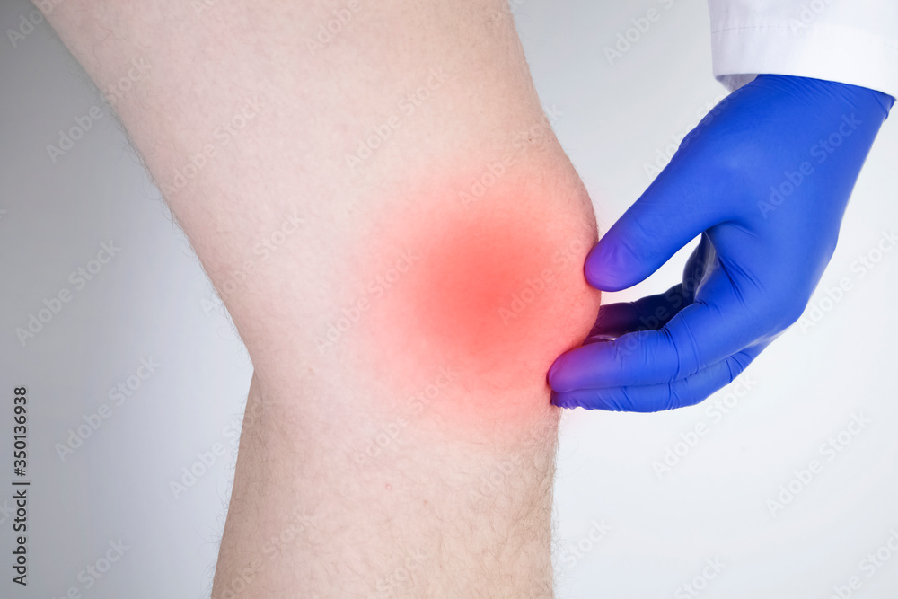 A man suffers from knee pain. Examination by an orthopedist and ...
