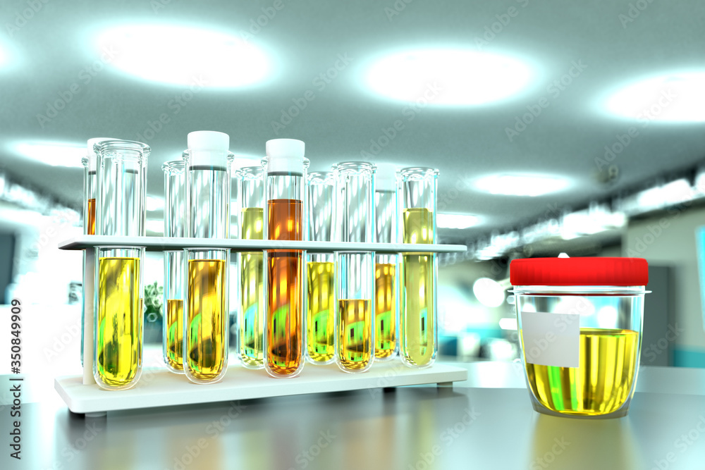 laboratory test tubes in modern pollution facility - urine quality test ...