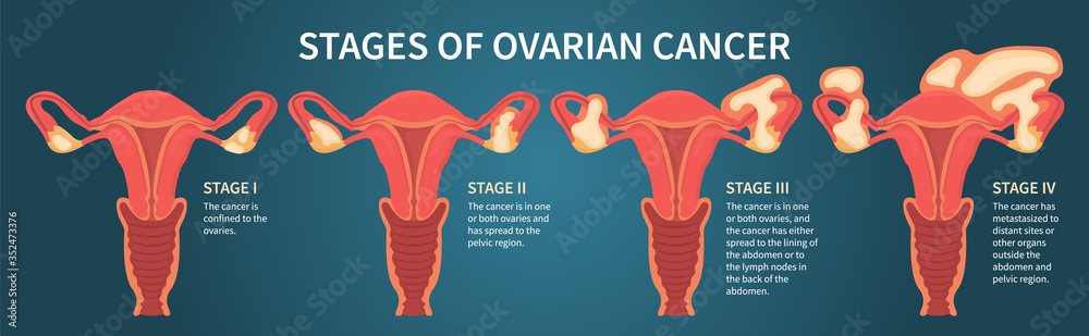 Image vectorielle Stock Woman reproductive system on dark blue ...