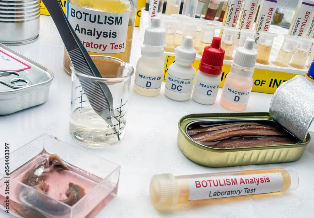 Samples contaminated by Clostridium botulinum toxin that causes ...