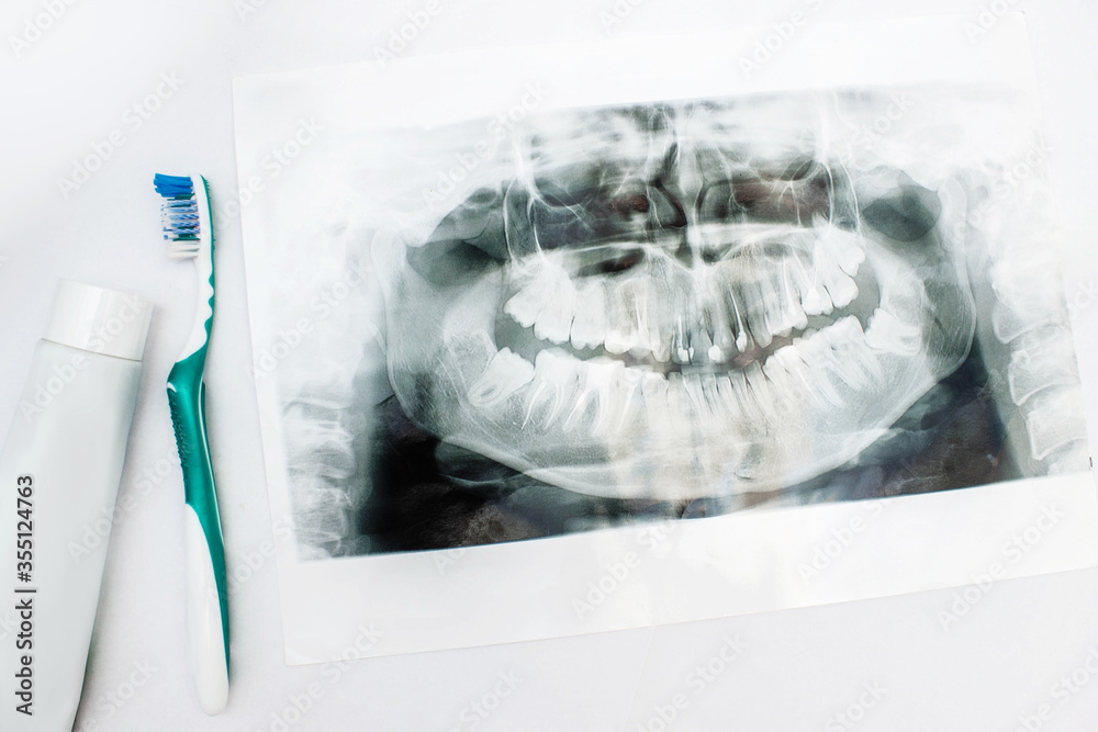 Image of doctor or dentist presenting with tooth x-ray film recommend ...