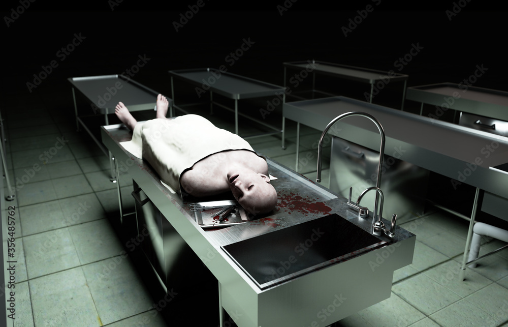 cadaver, dead male body in morgue on steel table. Corpse. Autopsy ...