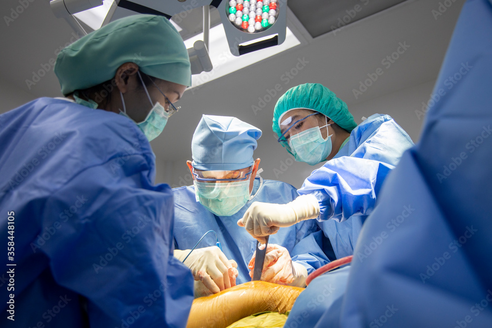 Team of doctor doing surgery inside modern operating room with orange ...