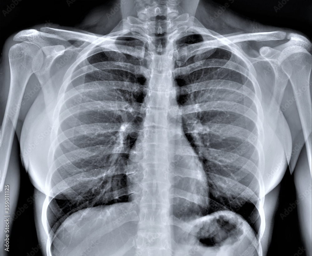 roentgenography of organs of a Stock Photo | Adobe Stock