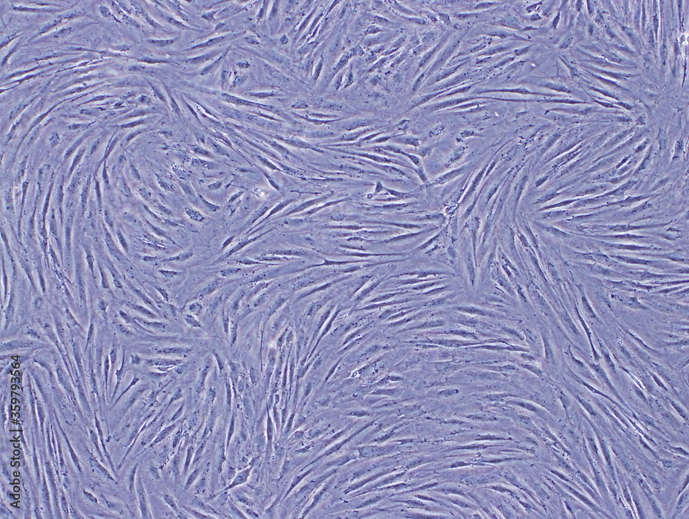 Fibroblasts ,the most common cells of connective tissue in animals ...