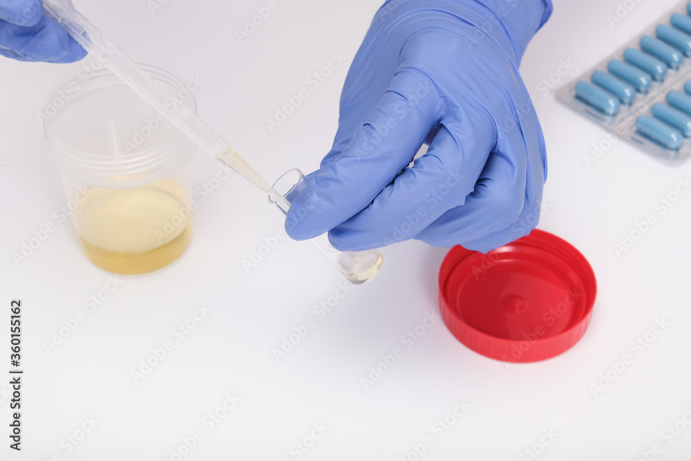 Fotografie A doctor, lab technician in blue gloves holding urine sample ...