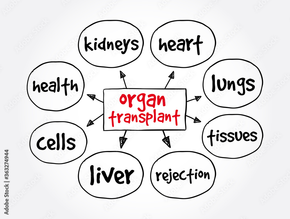 Organ Transplant mind map, medical concept for presentations and ...
