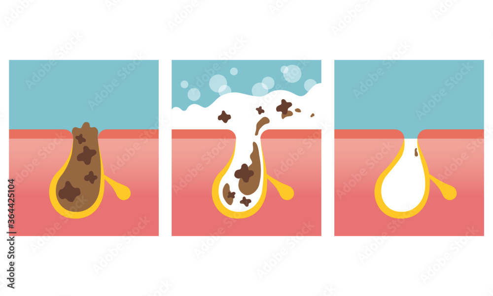 Pore cleansing, facial skin care image. Washing skin with soap. Vector ...