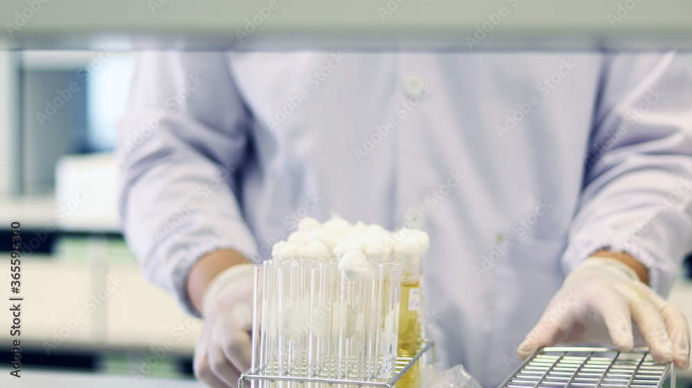 Scientist analysis E.Coli in food use Most Probable number (MPN ...