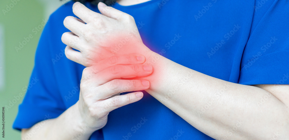 Foto de Stock Arthritis patient hand concept. Inflammation (swelling ...