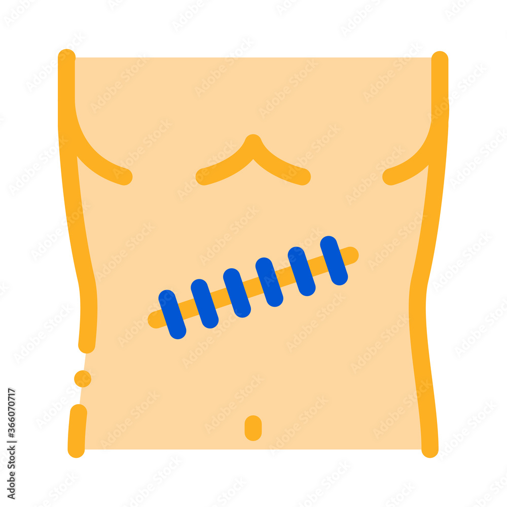 Image vectorielle Stock stitched surgical wound icon vector. stitched ...
