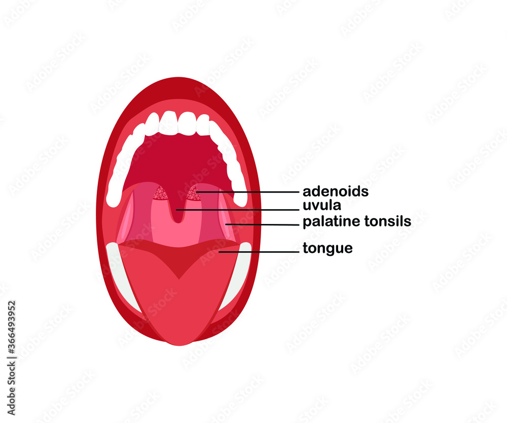 The norm and hypertrophy of the adenoids. Location of the adenoids ...