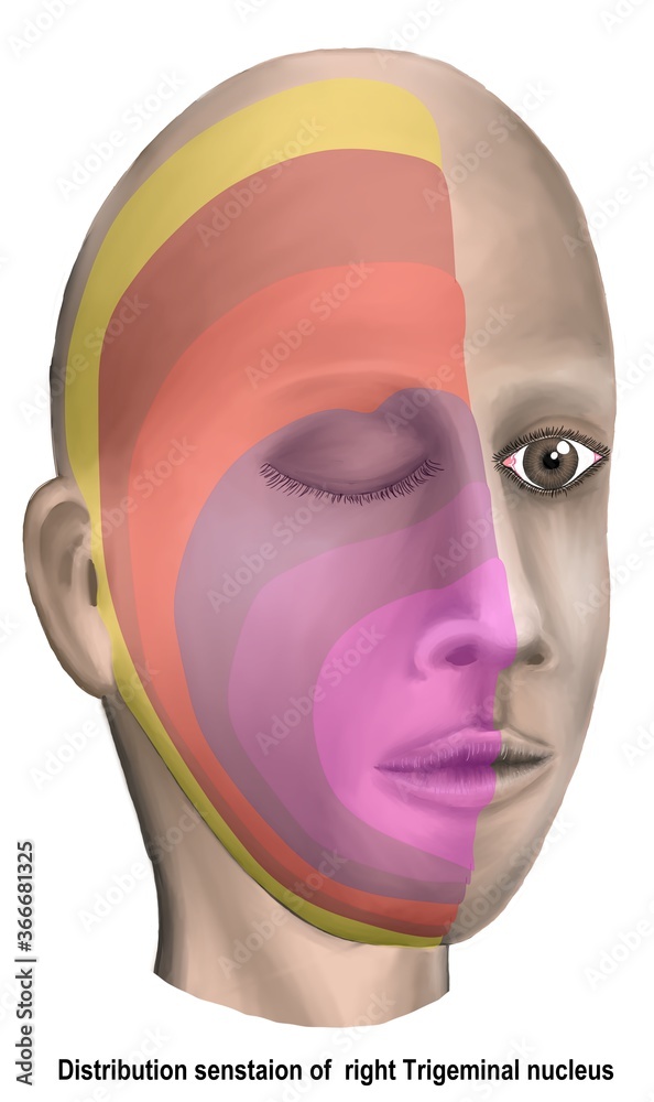 the onion skin pattern of facial sensation regarding to right ...